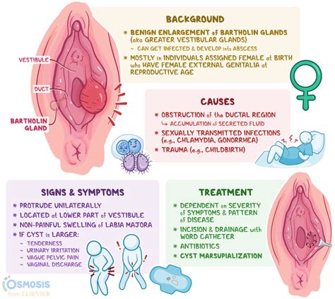 Gartner Duct Cyst Pictures Of S