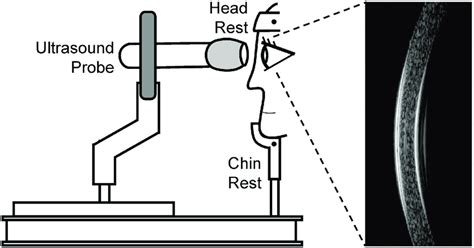 Ope Measurement Setup Showing A Subject Sitting In Front Of An Download Scientific Diagram