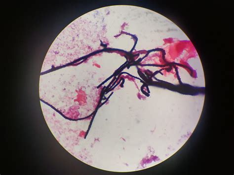 I Heard You Guys Like Mold This Is A Gram Stain Of Mold In Someones
