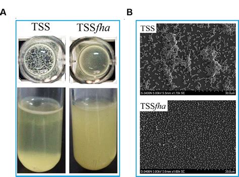 Pseudomonas Fluorescens Broth