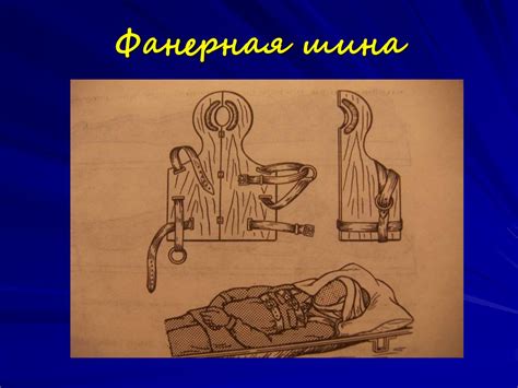 Иммобилизация в травматологии - online presentation
