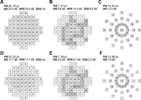 Extracting Sensitivity Parameters In Grids 1 And 2 A B Grid 1