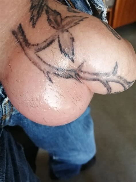 Saline Infuion Third 05 L Nacl And 05 L Glucose 26 Pics Xhamster