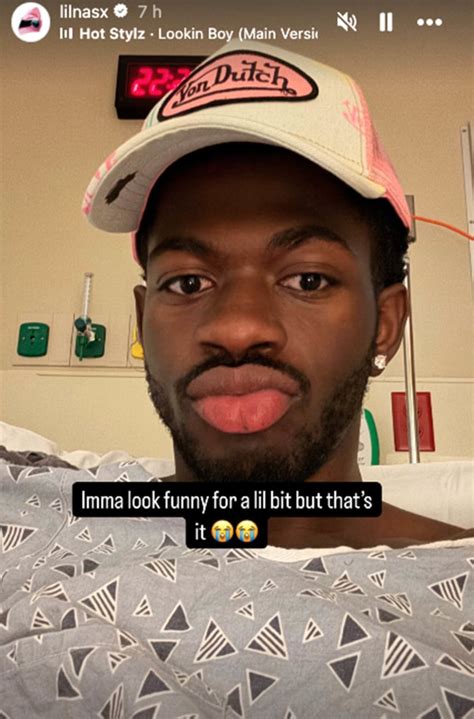 Lil Nax X Posts Video After He Lost Control Of Half Of Face