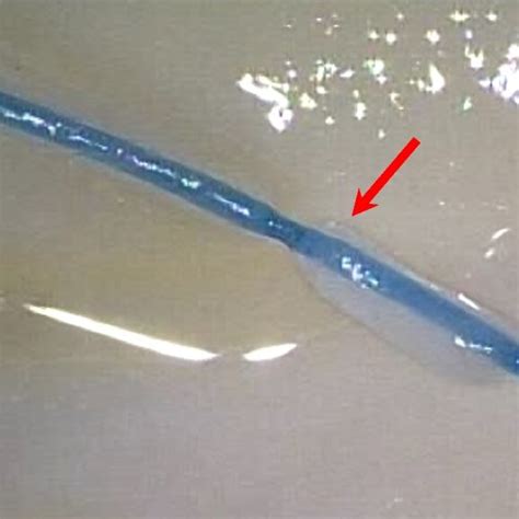 A Surgical Field After Lateral Orbitotomy With Visualization Of The