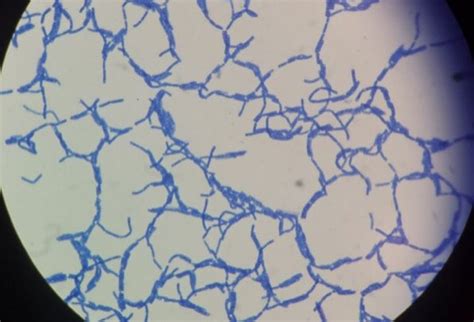 Bacillus Megaterium Acid Fast Stain