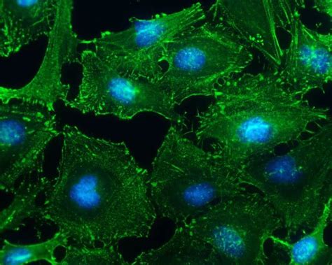 Sarcomeric Alpha Actinin抗体 Ab137346 Abcam中文官网