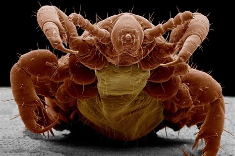 Insects Under Microscope