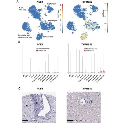 Expression Of Sars Cov 2 Cell Entry Factors Ace2 And Tmprss2 In The