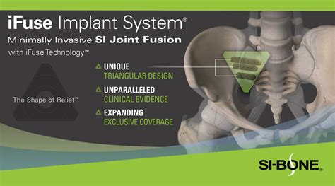 Si Bone Women Neurosurgeons Symposium Series