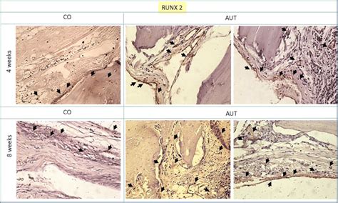 histological section showing positive immunolabeling for runx2 arrow