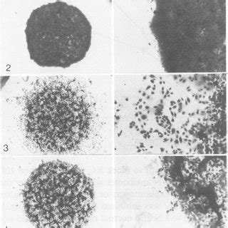 Morphology Of Mdck Cells Grown On Millipore Filters For 3 D The Apical