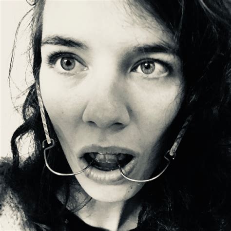 Van Beek Braces For Fun