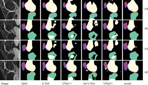 u‐net unet att u‐net unet3 and some example segmentation plots of