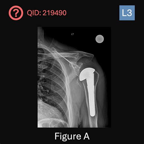 Orthobullets Can You Answer Our Free Question Of The Day A 71 Year Old Male Presents To The