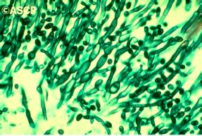 Streptomyces Nodosus Alchetron The Free Social Encyclopedia