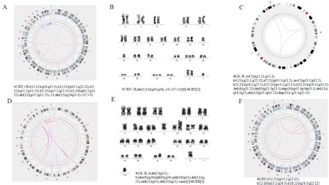 Figure 1 From Optical Genome Mapping For Comprehensive Assessment Of