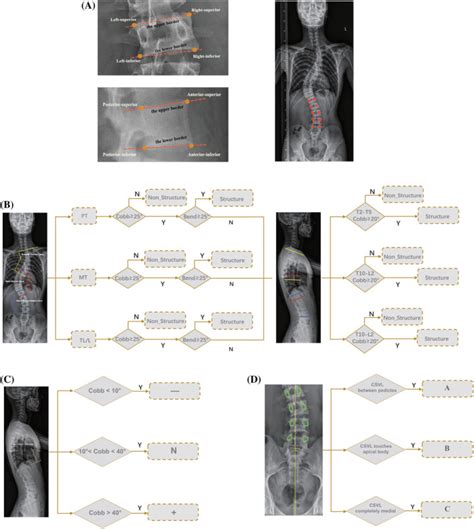 Automatic Lenke Classification Of Adolescent Idiopathic Scoliosis With Deep Learning Pmc