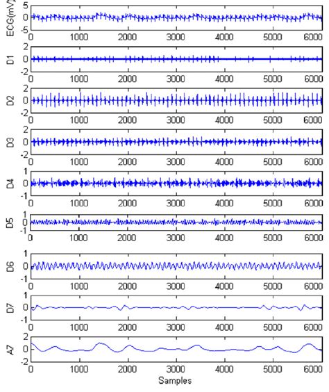 An Ecg Signal And Its Wavelet Decomposition Download Scientific Diagram