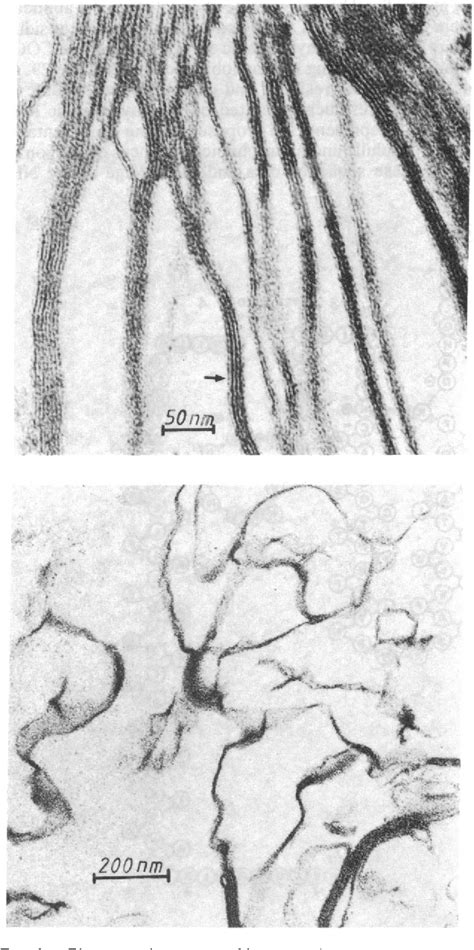Figure 1 From Structure And Molecular Arrangement Of Proteolipid Protein Of Central Nervous