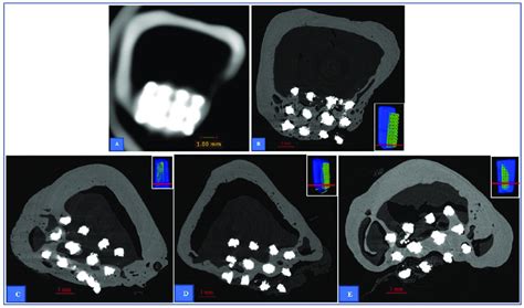 Bone Ingrowth Into Pores At Different Time Points By μct And Cbct