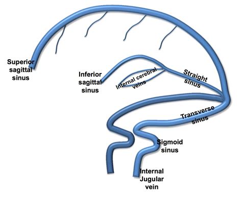 Cerebral Venous Thrombosis Pearls And Pitfalls Emdocs
