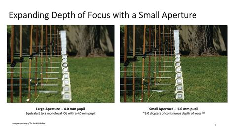 Small Aperture Iol Technology Offers Benefits To Patients Optometrists