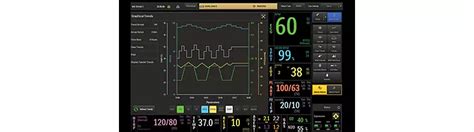 Philips Expression Ip5 Information Portal Philips