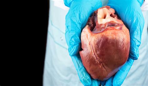 Matthew Danter Posted On Linkedin