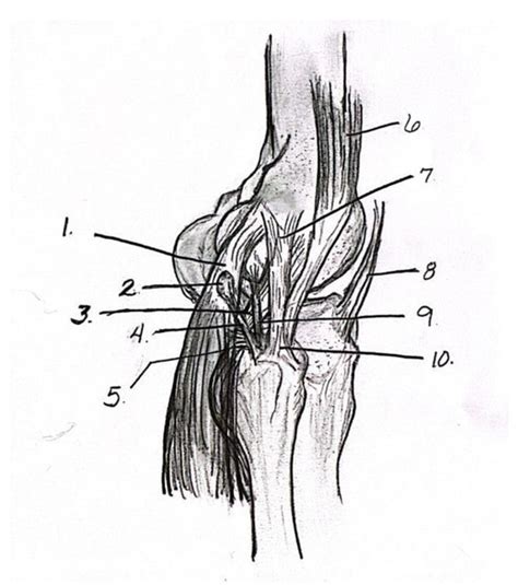 Fabella Syndrome Anatomy Diagnosis Treatment And Outcomes