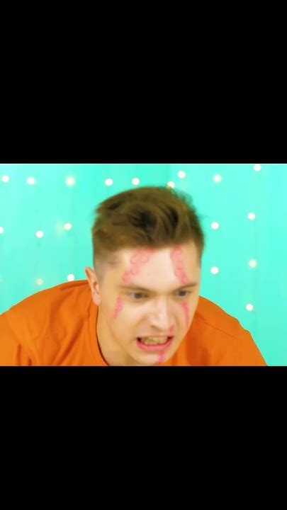 그 남자가 이마에 흔적이 남아있는 채 탁자에서 나타난다 Youtube