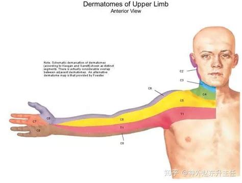 臂丛神经损伤是怎么回事？该怎么治疗？ 知乎