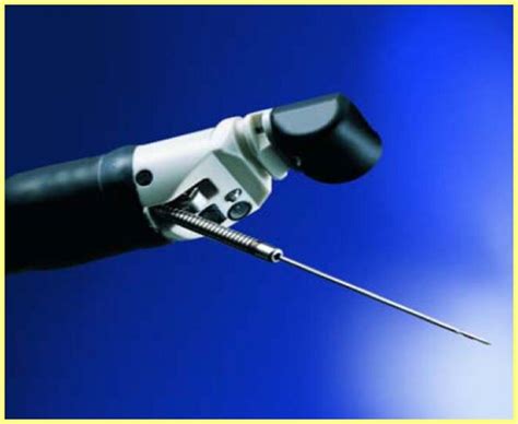 Distal End Of The Eus Scope With Permission From Olympus Tokyo Japan Download Scientific