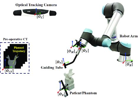 the involved coordinate systems for robot assisted image guided