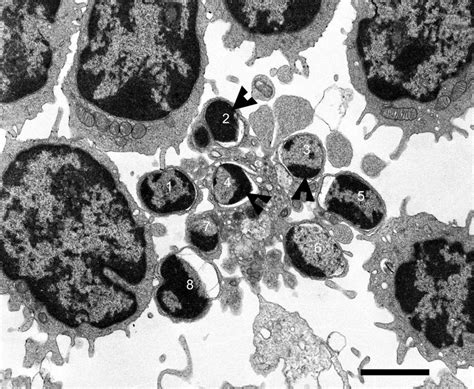 11 Morphological Characteristics Of Cells Undergoing Apoptosis