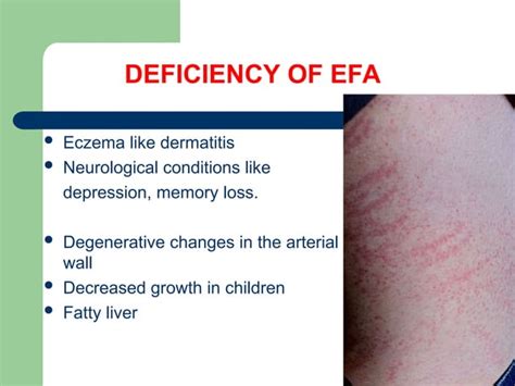 Lipid Chemistry With Classification Of Lipidsppt