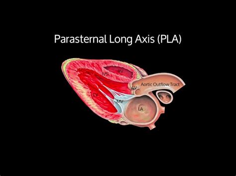 Understanding Basic Transthoracic Echocardiography A Comprehensive Guide Galaxy Ai
