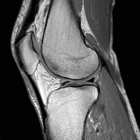 Musculoskeletal Imaging And Intervention Ohsu