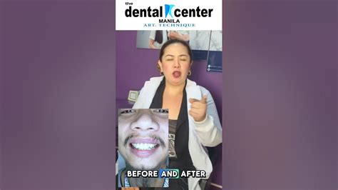 Micrognathia Under Jaw Disorder Youtube