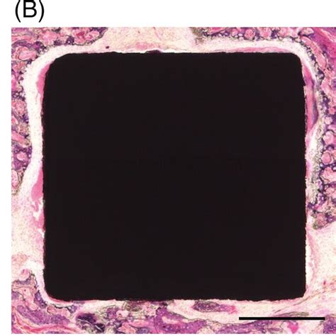 Photomicrographs Taken In The Sagittal Plane Of Rat Intervertebral Disc