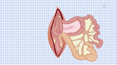 Generation Of Mouse Proximal Colon Loop Model A Surgical Procedure To