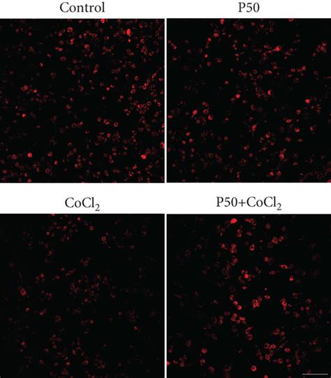 Propofol Ameliorates The Decrease In Mitochondrial Membrane Potential