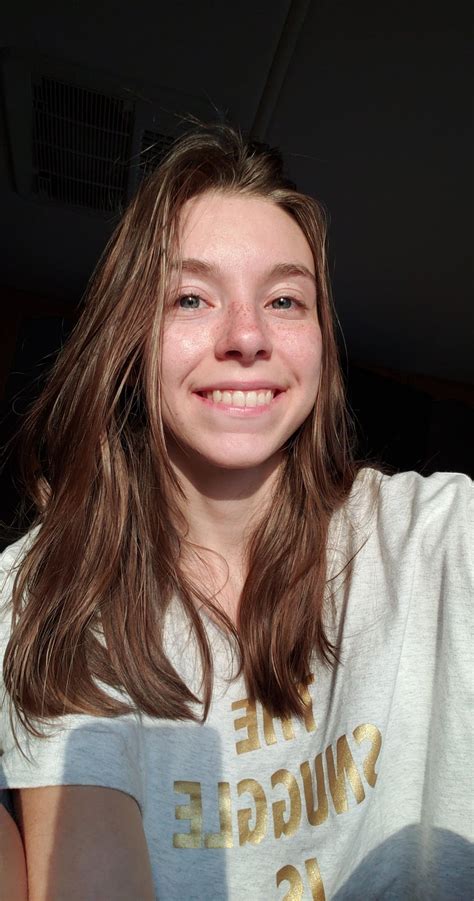 My Freckles Get So Faint In The Winter 😭 R Freckledgirls