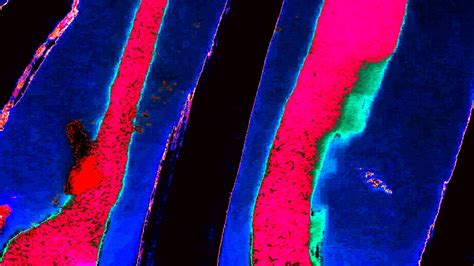 Fluorescent Dyes Enhance Polymer Visibility In Biomedical Imaging Bruker