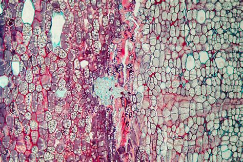 Cinnamon Bark Microscope