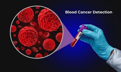 What To Expect During A Blood Cancer Detection Test