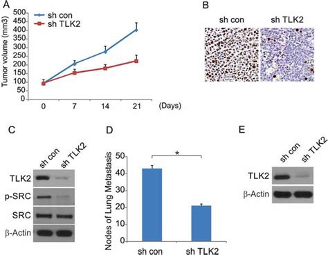 Tlk2 Enhances Aggressive Phenotypes Of Glioblastoma Cells Through The Activation Of Src