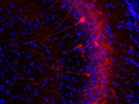 Synaptic Systems Gmbh On Linkedin Neuroscience Antibodies