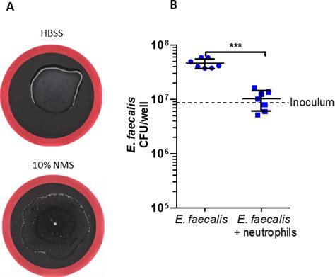 Enterococcus Faecalis Colony Morphology
