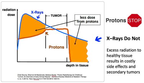Proton Beam Therapy Cost Advantages Challenges Upsc Notes